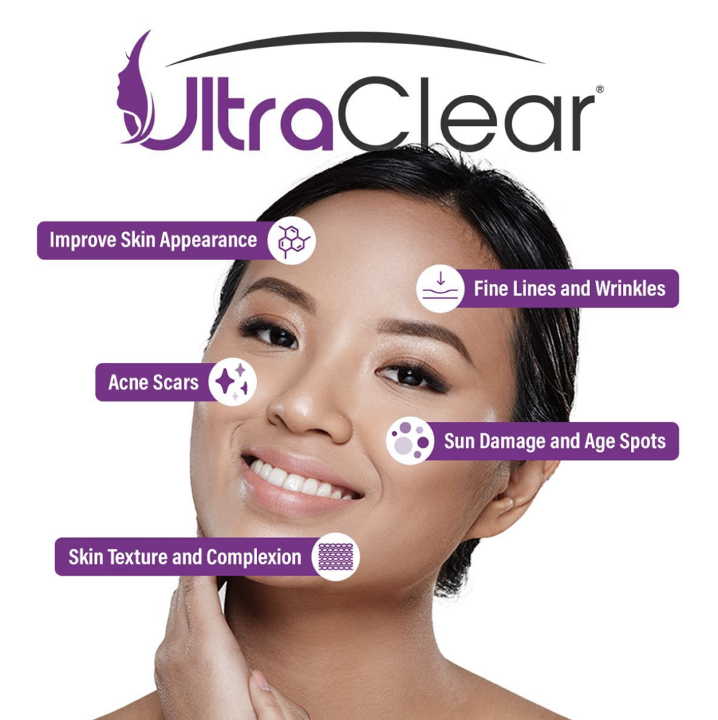 Everything You Need to Know About This New 15 Minute Laser Treatment ...