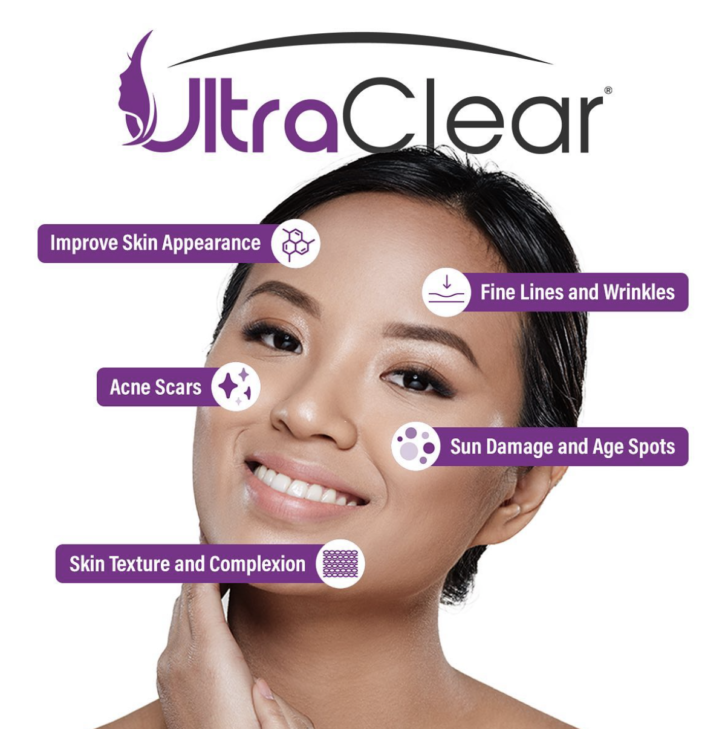 Everything You Need to Know About This New 15 Minute Laser Treatment ...